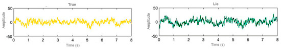 An Automatic Lie Detection Model Using EEG Signals Based on the ...
