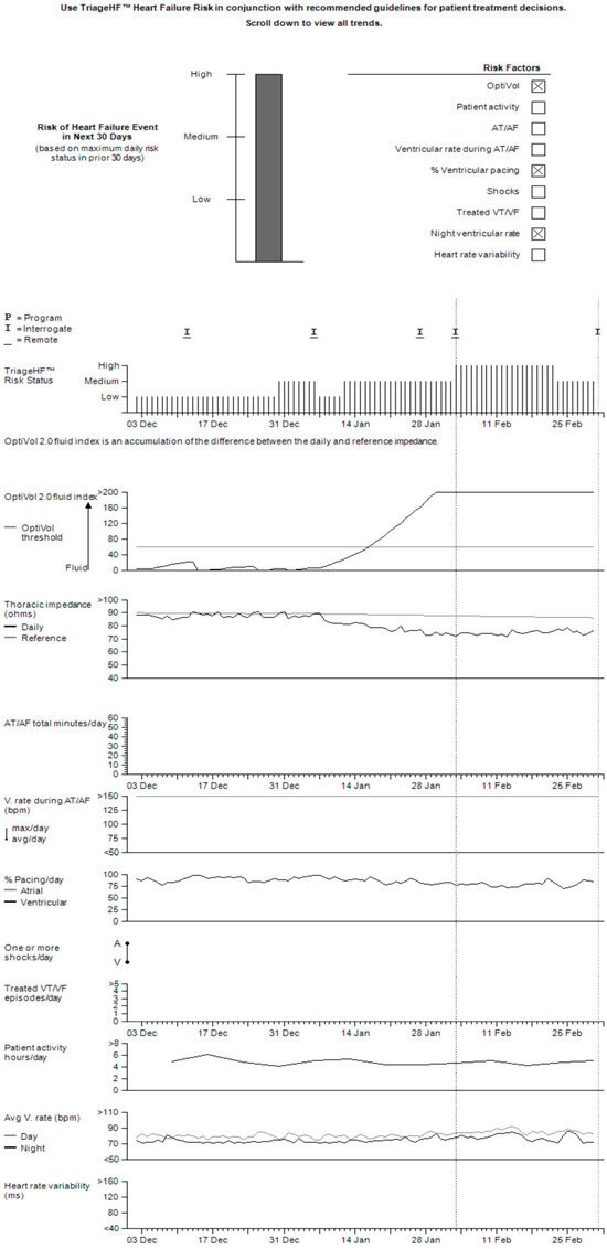 Efficacy of the Cardiac Implantable Electronic Device Multisensory ...
