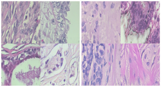 Sensors | Free Full-Text | Enhancing Histopathological Image Classification Performance through ...