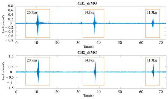 A Surface Electromyography (sEMG) System Applied for Grip Force Monitoring