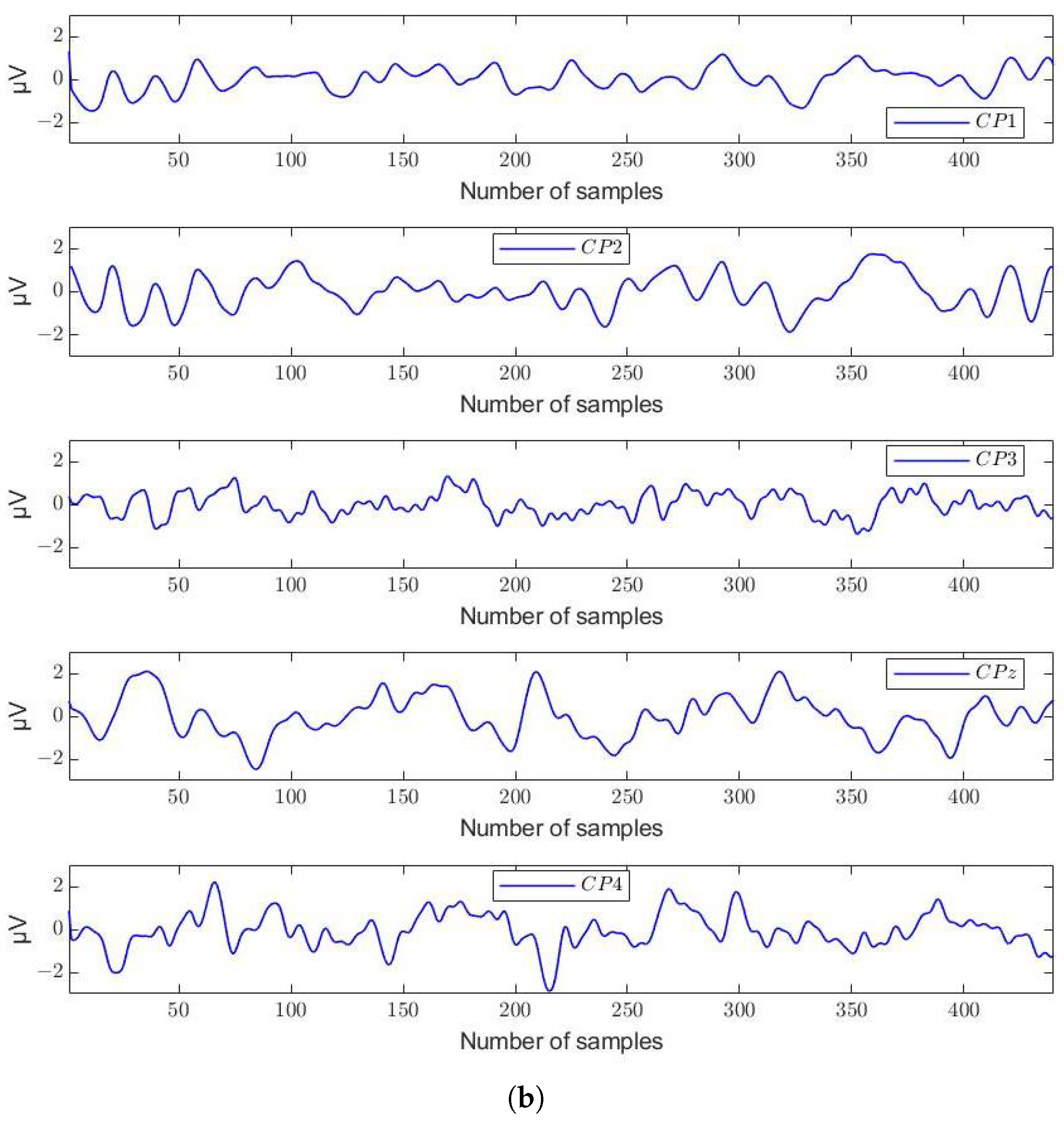 Sensors | Free Full-Text | Multiclass Classification of Visual Electroencephalogram Based on ...
