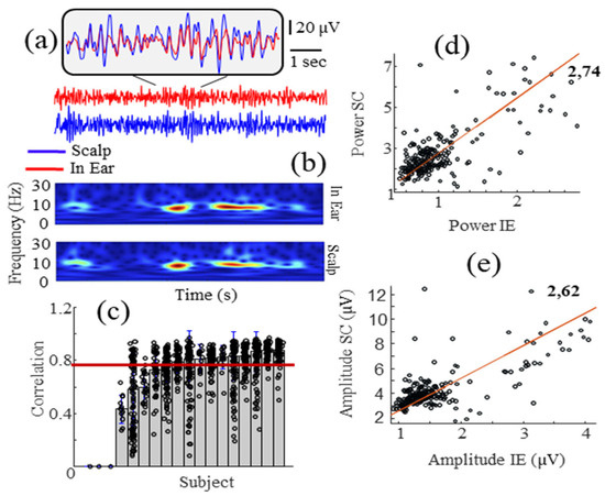 Evaluating the Electroencephalographic Signal Quality of an In-Ear ...
