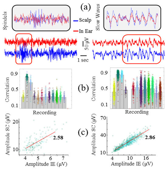 Evaluating the Electroencephalographic Signal Quality of an In-Ear ...