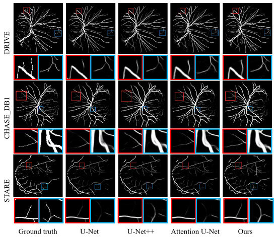 A Microvascular Segmentation Network Based on Pyramidal Attention Mechanism