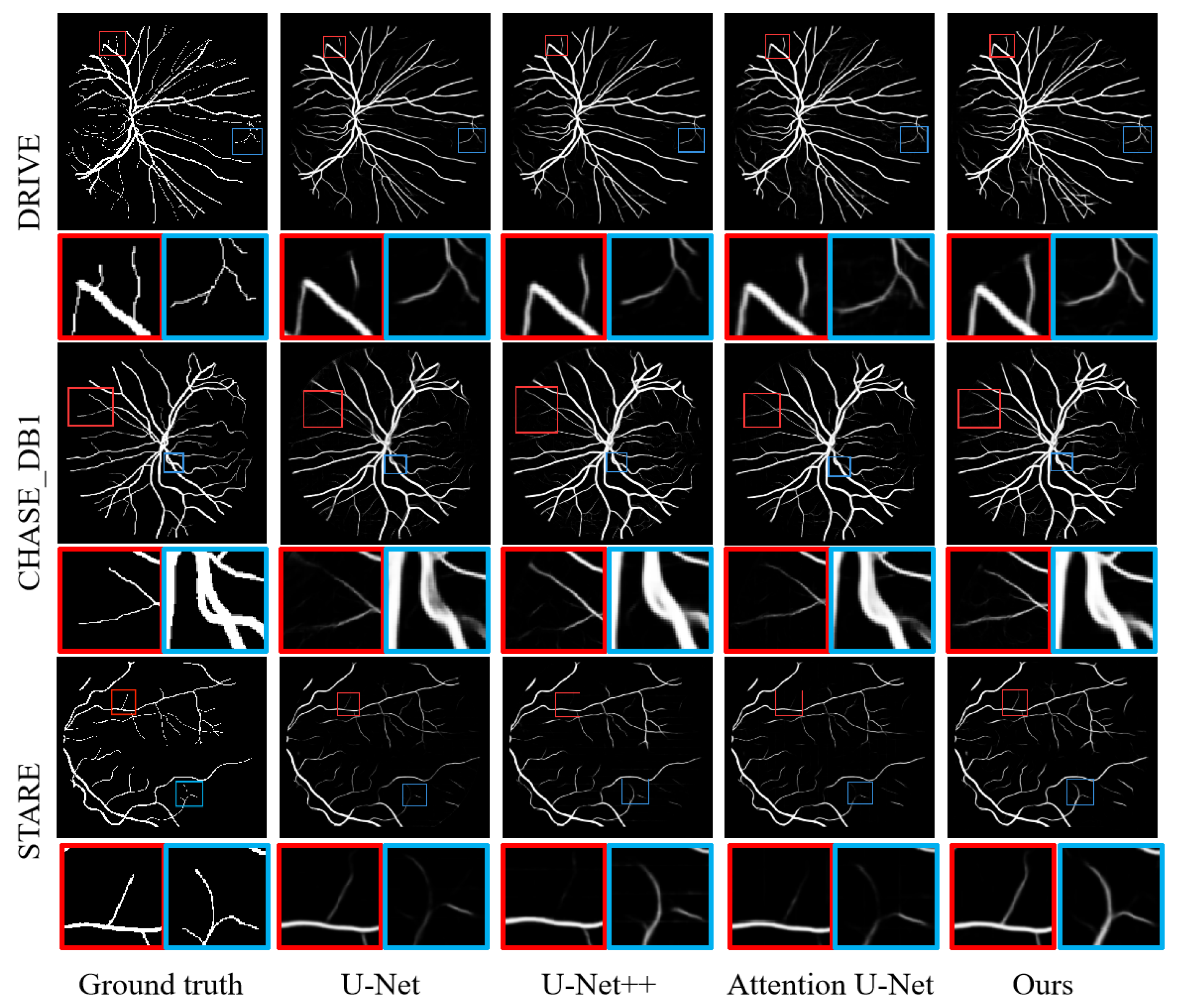 A Microvascular Segmentation Network Based on Pyramidal Attention Mechanism
