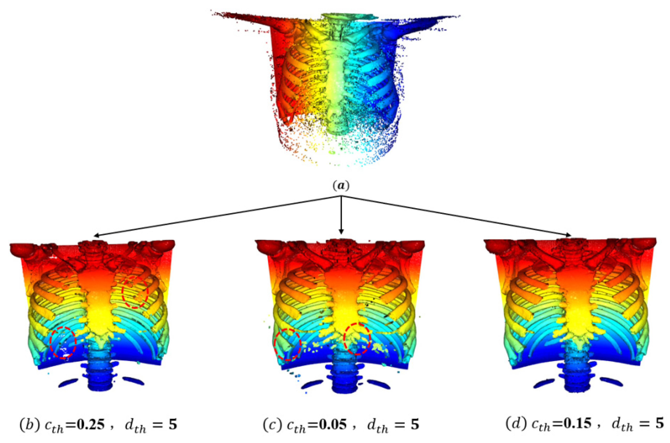 Research on Three-Dimensional Reconstruction of Ribs Based on Point Cloud Adaptive Smoothing ...