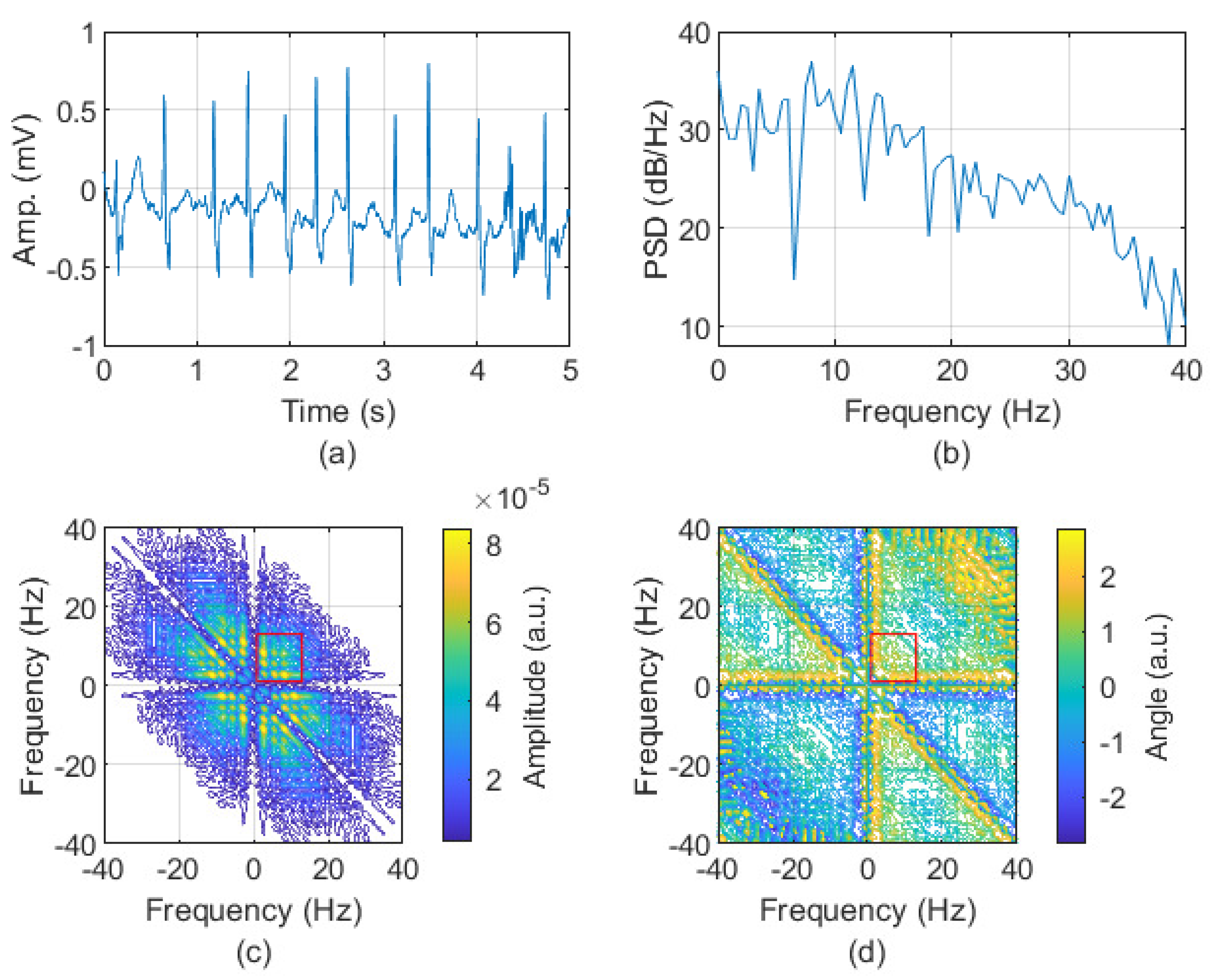 Sensors | Free Full-Text | Higher-Order Spectral Analysis Combined with a Convolution Neural ...