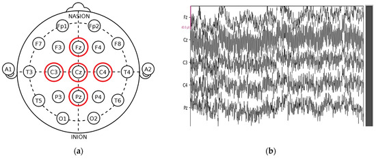 Sensors | Free Full-Text | Efficient Generalized Electroencephalography ...