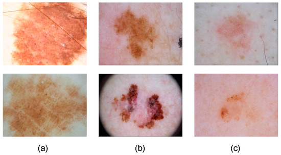 ELA-Net: An Efficient Lightweight Attention Network for Skin Lesion ...