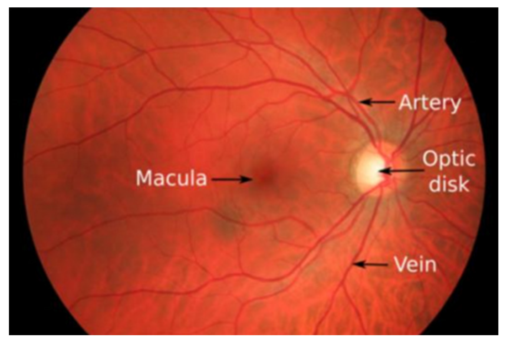 A Novel Single-Sample Retinal Vessel Segmentation Method Based on Grey Relational Analysis