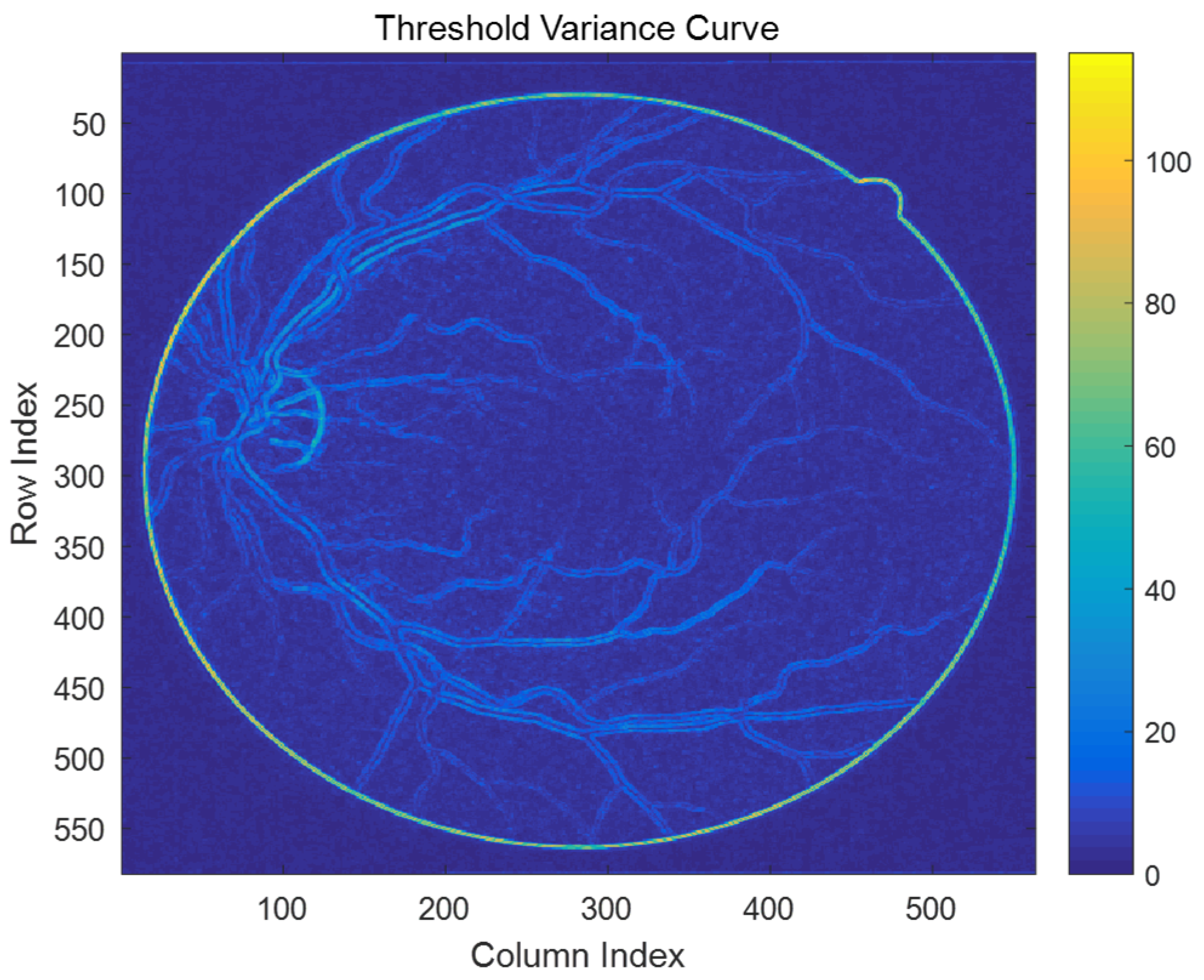 A Novel Single-Sample Retinal Vessel Segmentation Method Based on Grey ...