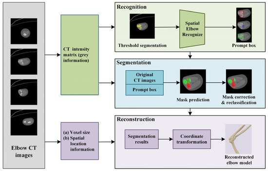 An Automatic Method for Elbow Joint Recognition, Segmentation and ...