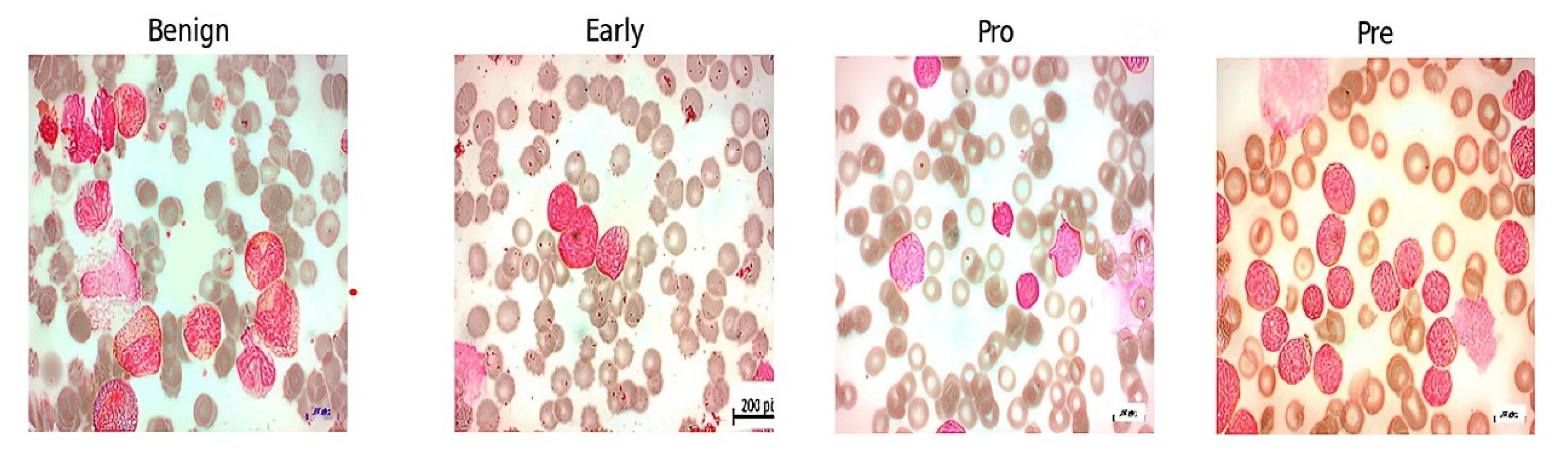 Sensors | Free Full-Text | Utilizing Deep Feature Fusion for Automatic ...