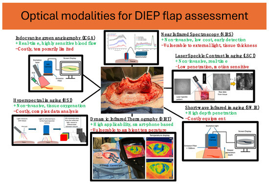 Sensors | Free Full-Text | Advancing DIEP Flap Monitoring with Optical Imaging Techniques: A ...