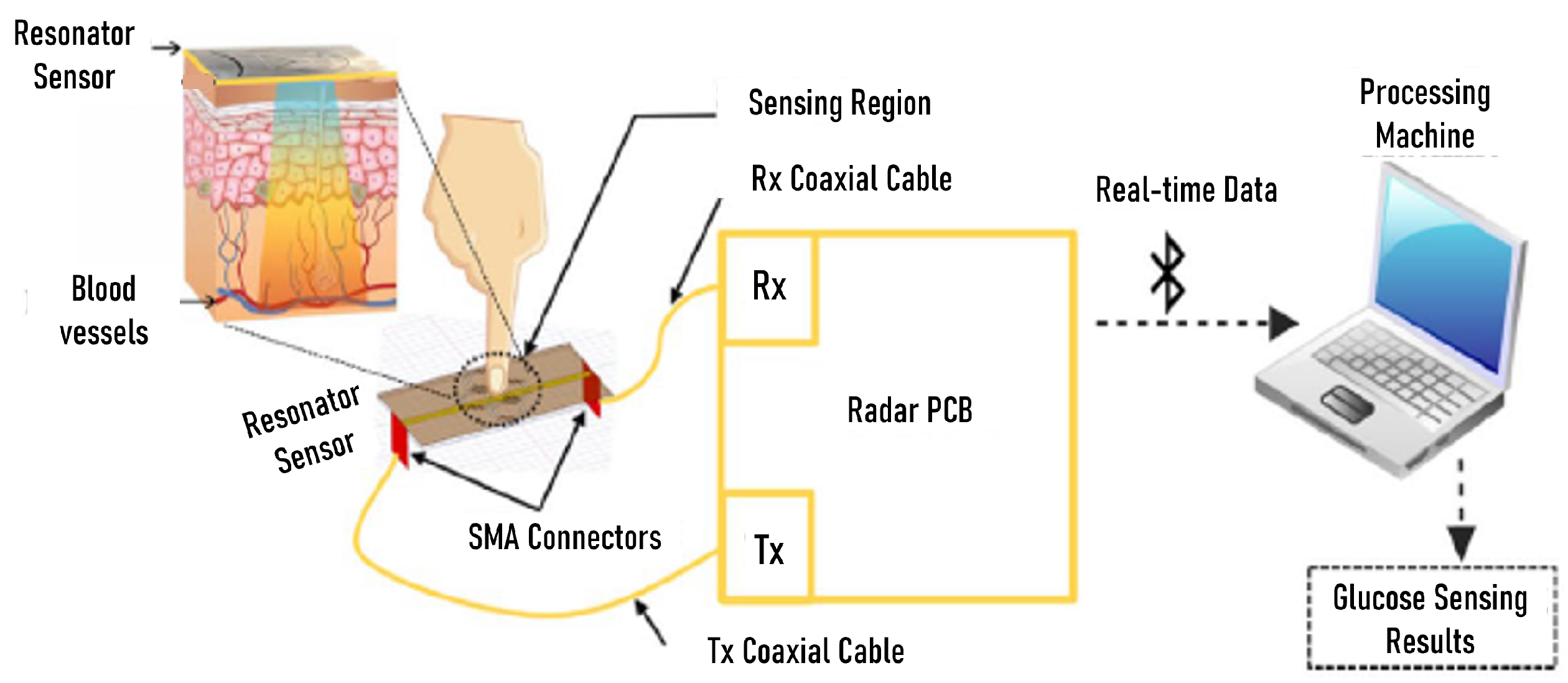 Sensors | Free Full-Text | Review of Microwave Near-Field Sensing and Imaging Devices in Medical ...
