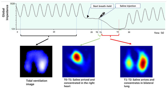 Sensors | Free Full-Text | Technical Principles and Clinical ...