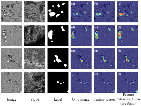 Sensors | Free Full-Text | A Deep-Learning-Based Algorithm for ...