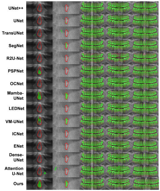 DeMambaNet: Deformable Convolution and Mamba Integration Network for ...