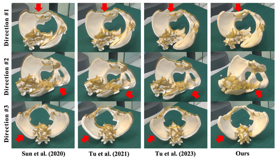 Robot-Assisted Augmented Reality (AR)-Guided Surgical Navigation for ...