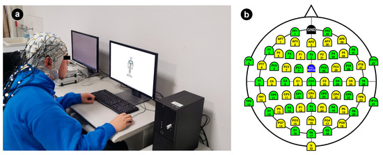 How the Degree of Anthropomorphism of Human-like Robots Affects Users ...