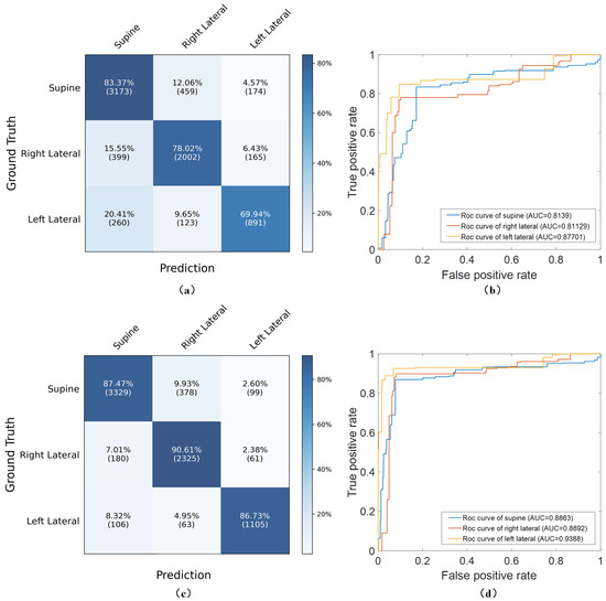 Smart Sleep Monitoring: Sparse Sensor-Based Spatiotemporal CNN for Sleep Posture Detection