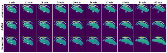 Improving Nowcasting of Intense Convective Precipitation by ...