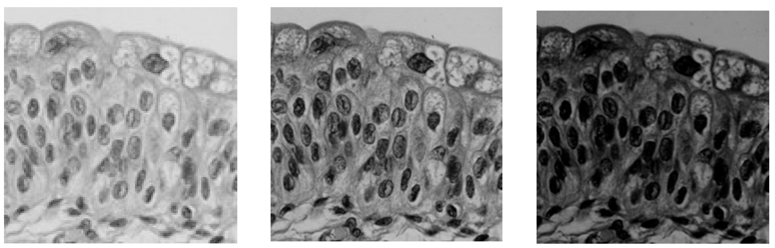Image Enhancement Thanks to Negative Grey Levels in the Logarithmic Image Processing Framework