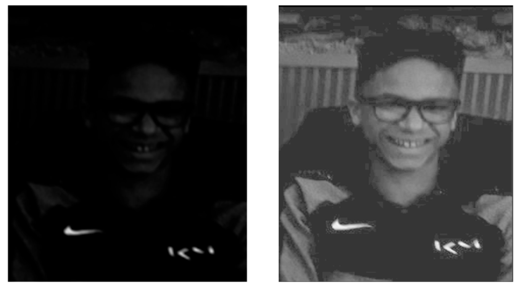 Image Enhancement Thanks to Negative Grey Levels in the Logarithmic Image Processing Framework