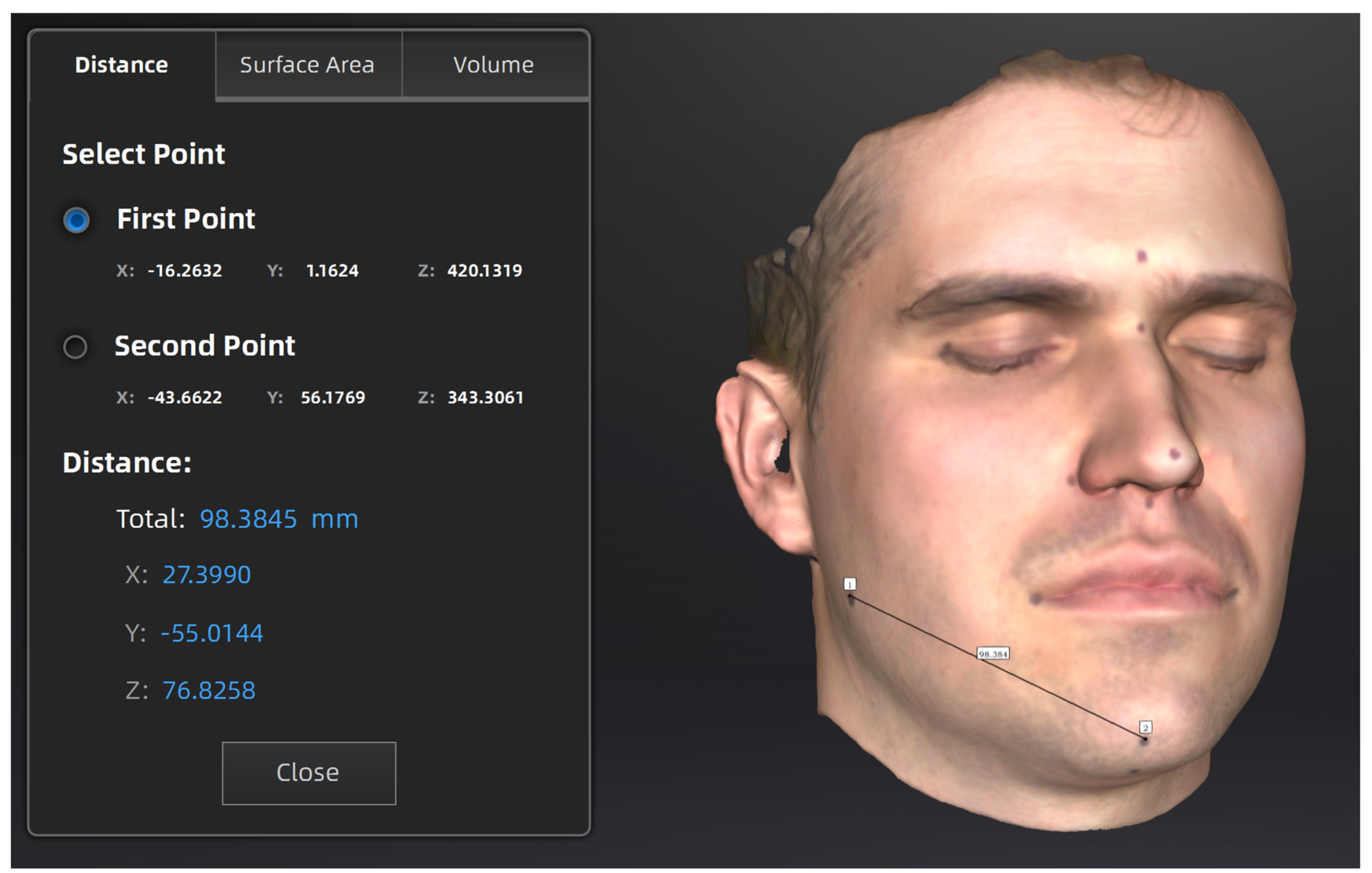 Evaluation of a Structured Light Scanner for 3D Facial Imaging: A ...