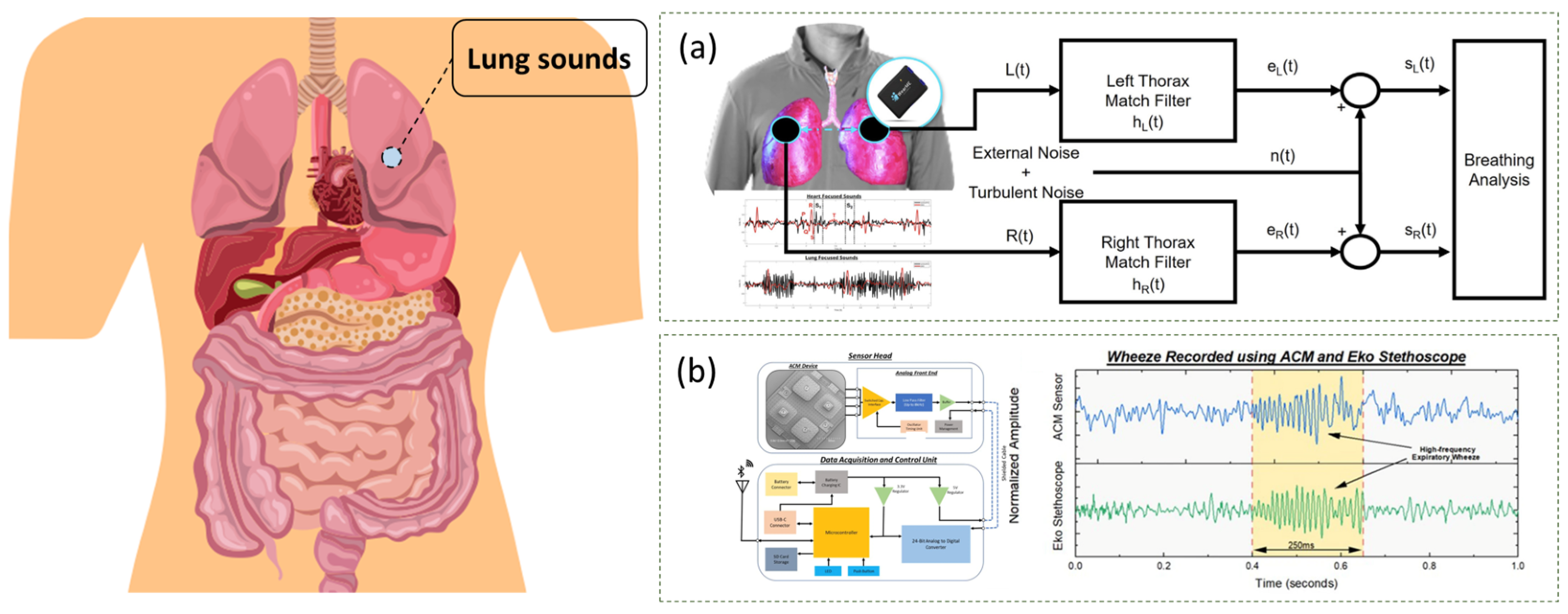 Advances in Portable and Wearable Acoustic Sensing Devices for Human ...