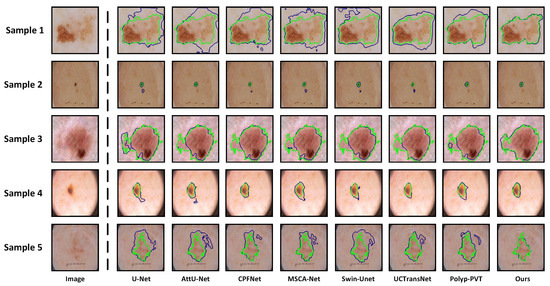 Sensors | Free Full-Text | MASDF-Net: A Multi-Attention Codec Network with Selective and Dynamic ...