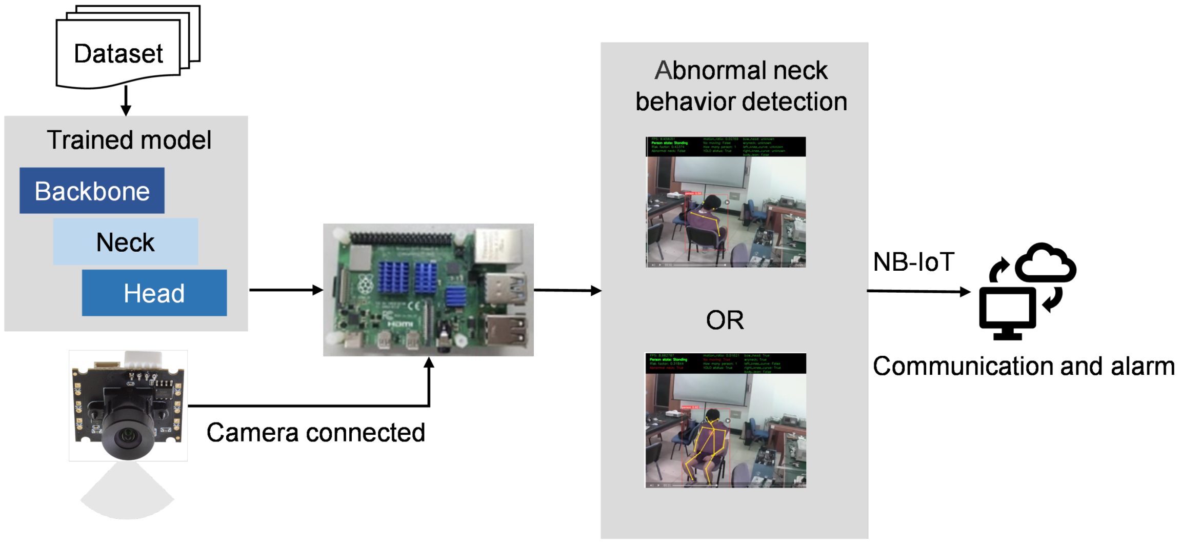 NABNet: Deep Learning-Based IoT Alert System for Detection of Abnormal Neck Behavior