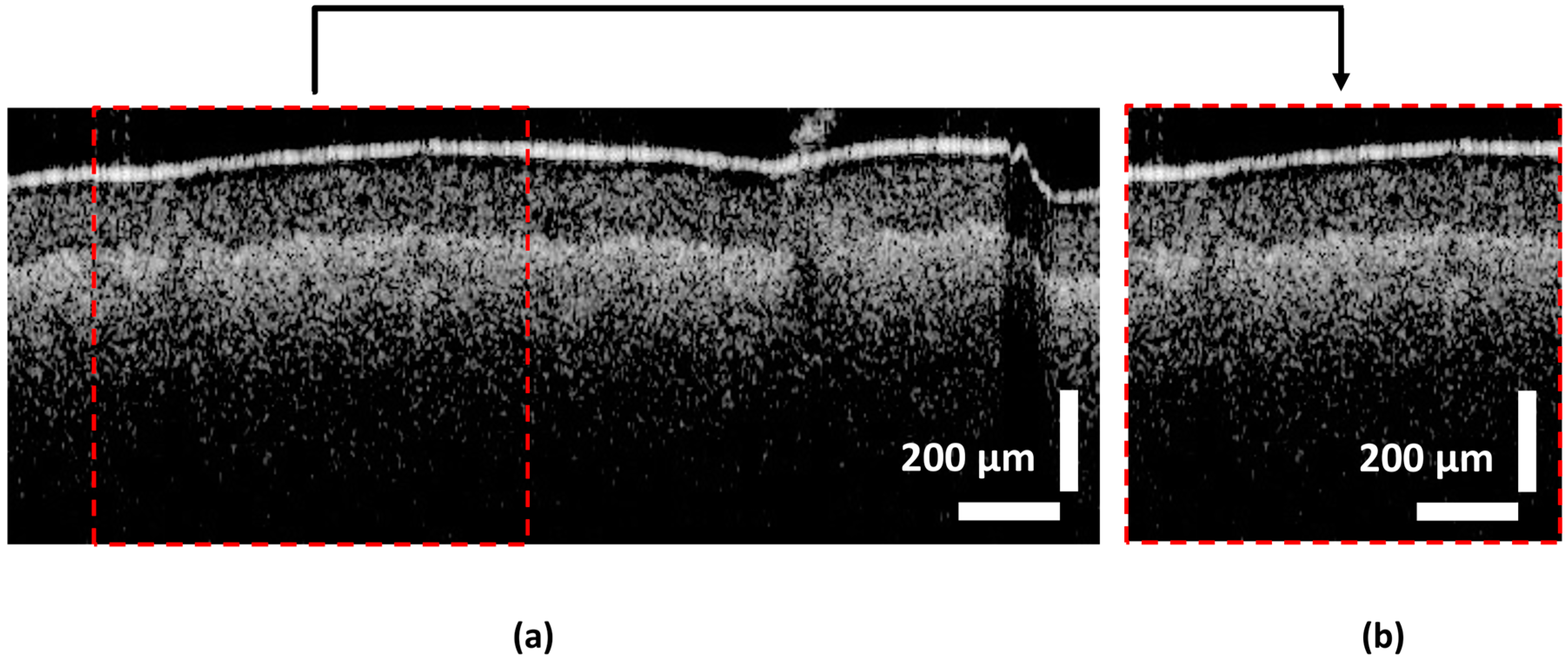 Sensors | Free Full-Text | Dense Convolutional Neural Network-Based Deep Learning Pipeline for ...