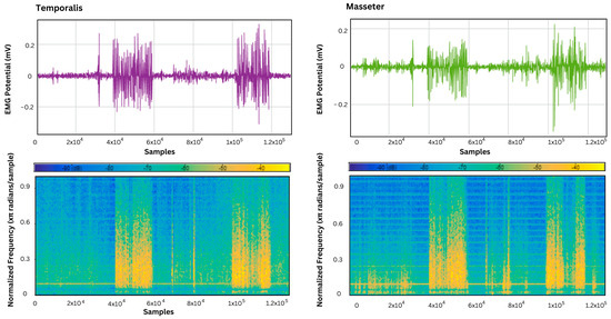 Advanced Sensing System for Sleep Bruxism across Multiple Postures via ...