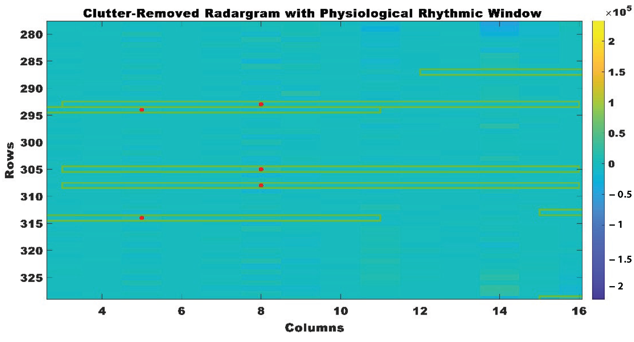 Therapeutic Exercise Recognition Using a Single UWB Radar with AI ...