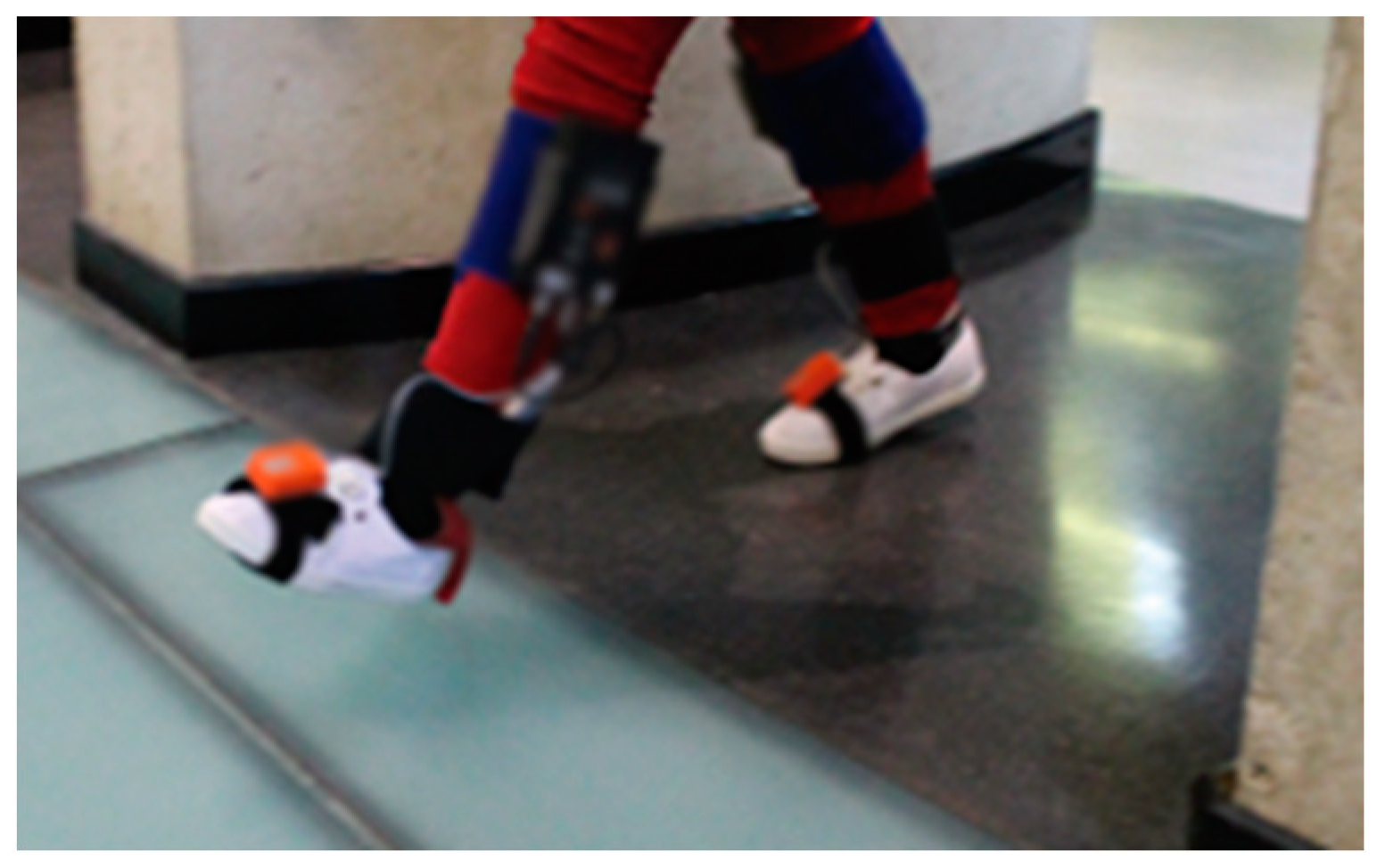 The Effect of Dimple Insole Design on the Plantar Temperature and ...