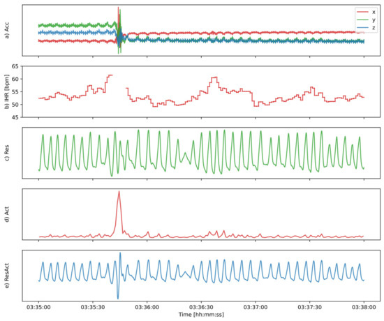 Overnight Sleep Staging Using Chest-Worn Accelerometry