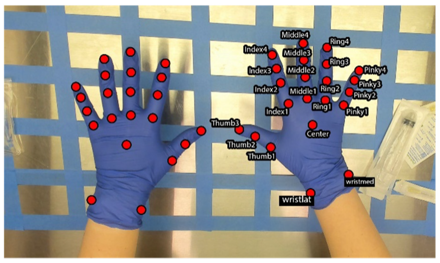 Enhanced 2D Hand Pose Estimation for Gloved Medical Applications: A ...