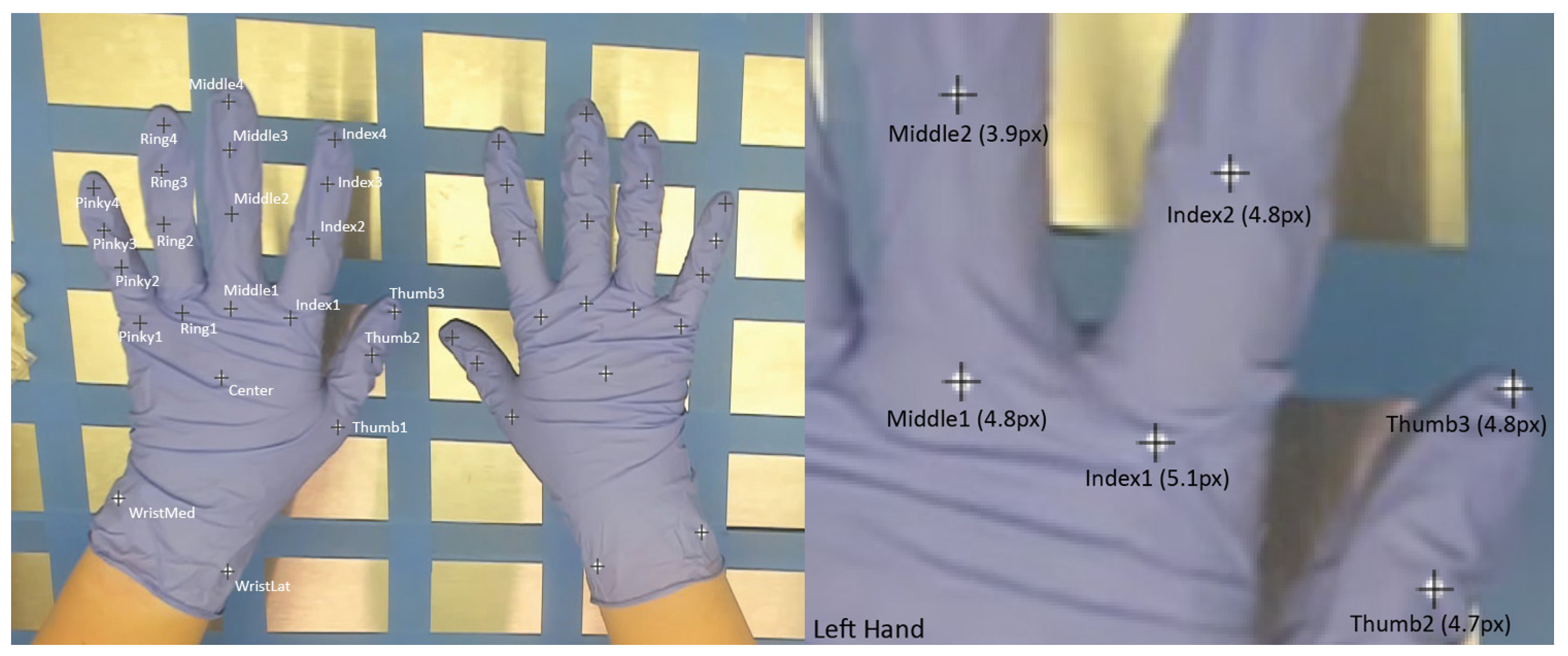 Enhanced 2D Hand Pose Estimation for Gloved Medical Applications: A ...