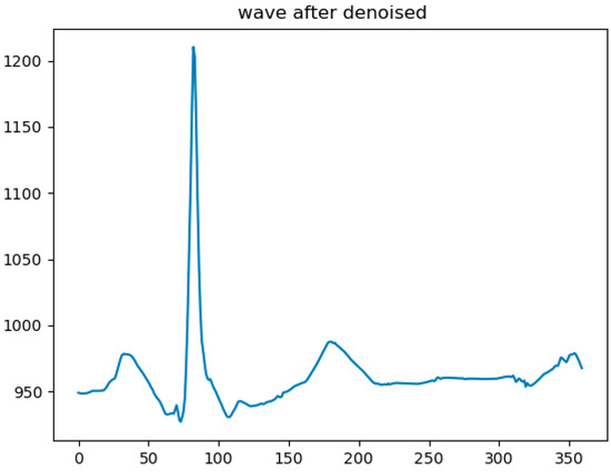An Arrhythmia Classification Model Based on a CNN-LSTM-SE Algorithm
