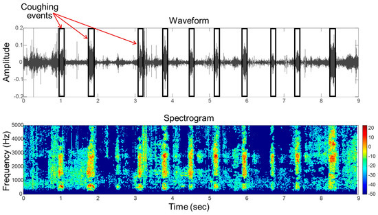 An Overview of Software Sensor Applications in Biosystem Monitoring and Control