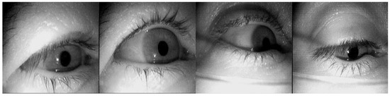 Wearable Biosensor Smart Glasses Based on Augmented Reality and Eye ...