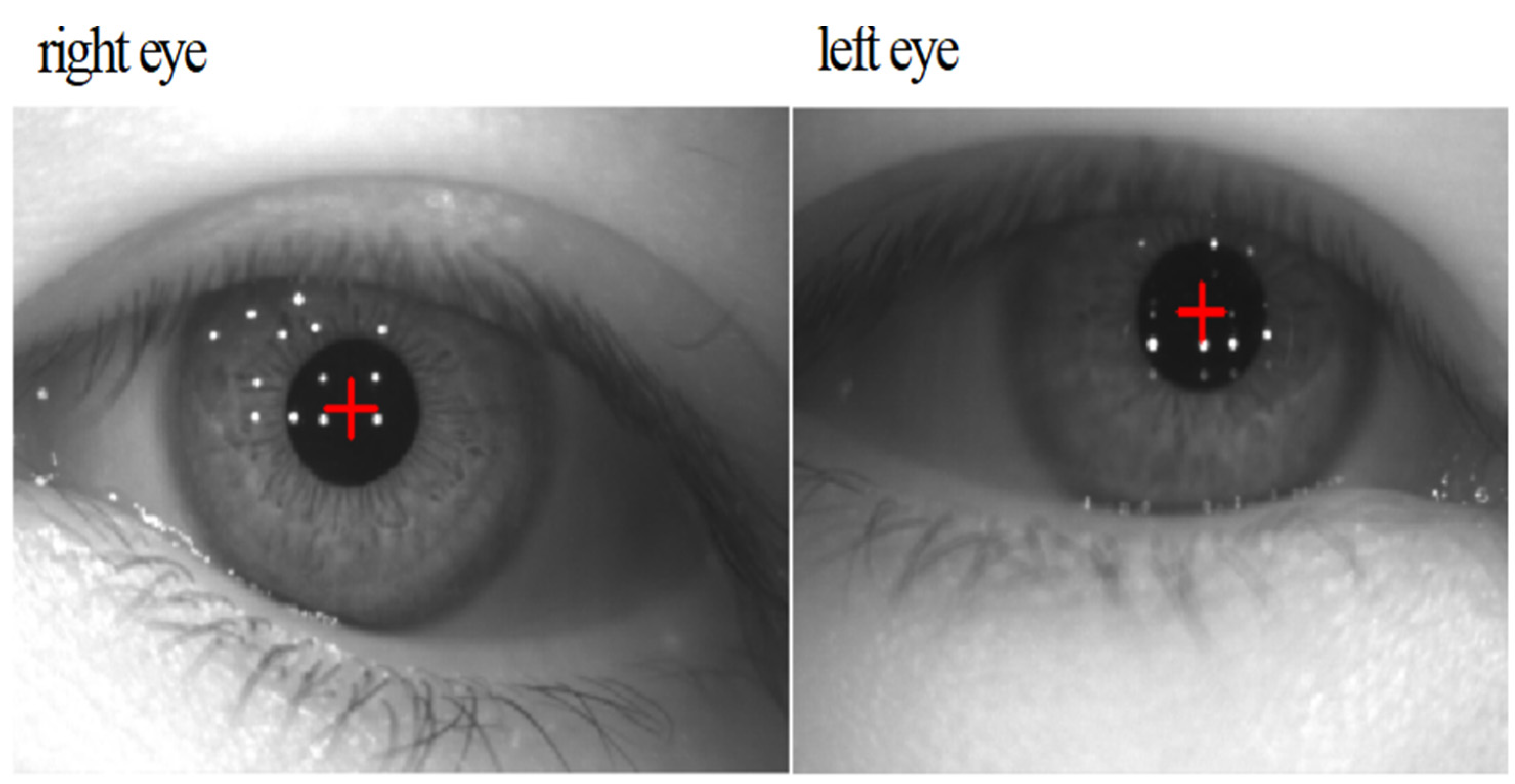 Wearable Biosensor Smart Glasses Based on Augmented Reality and Eye ...