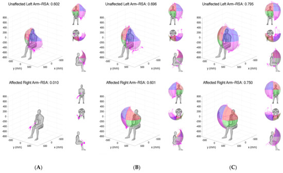Sensor-Acquired Reachable Workspace (RWS) Correlates with Activities of ...