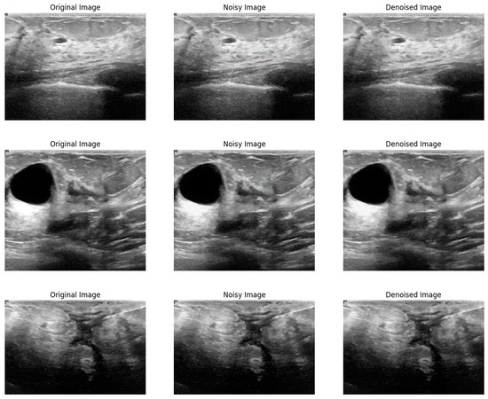 Enhanced Wavelet-Based Medical Image Denoising with Bayesian-Optimized ...