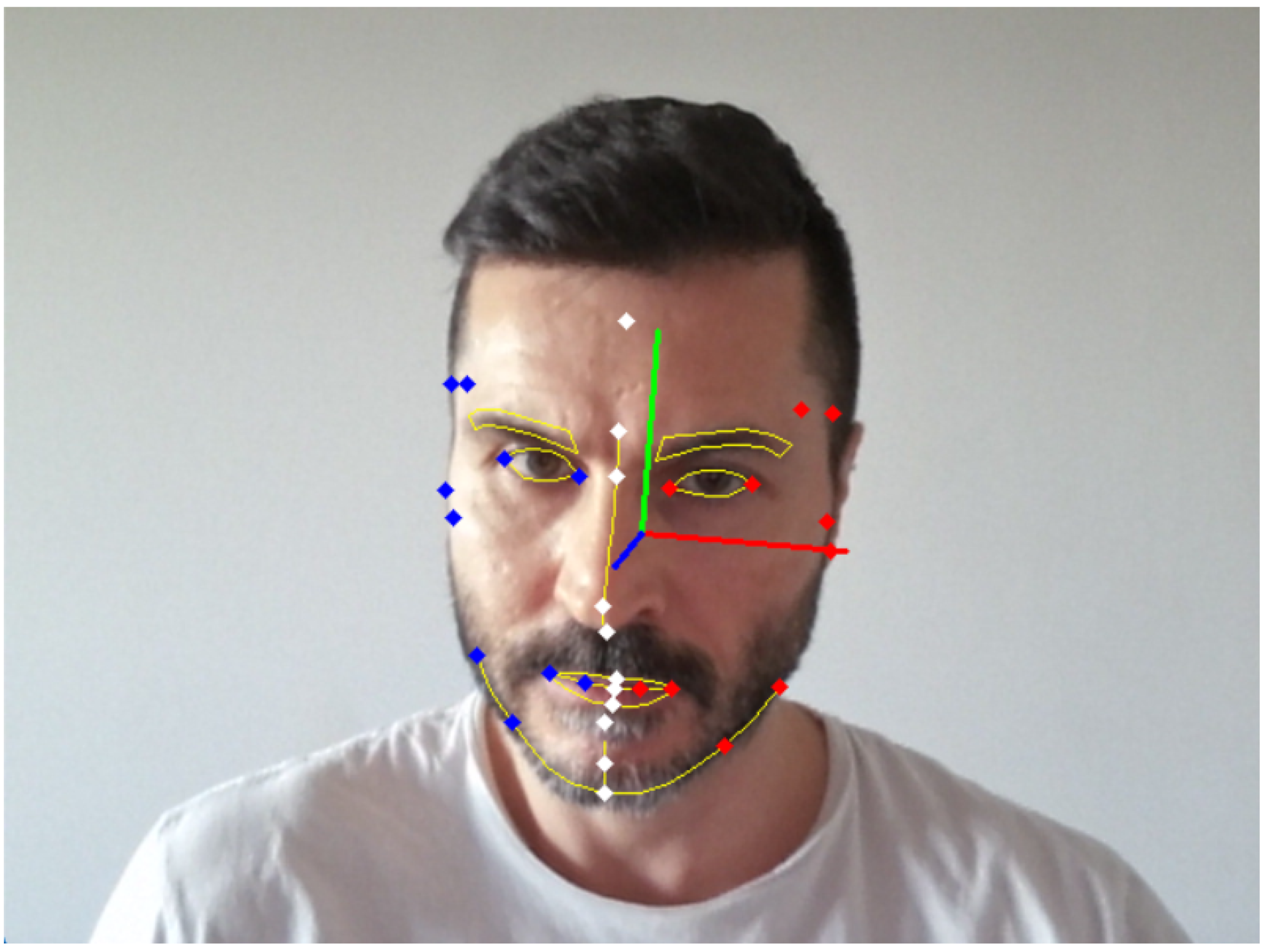 Facial Movements Extracted from Video for the Kinematic Classification ...