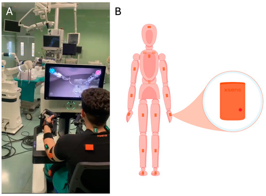 Correlation Study and Predictive Modelling of Ergonomic Parameters in Robotic-Assisted ...