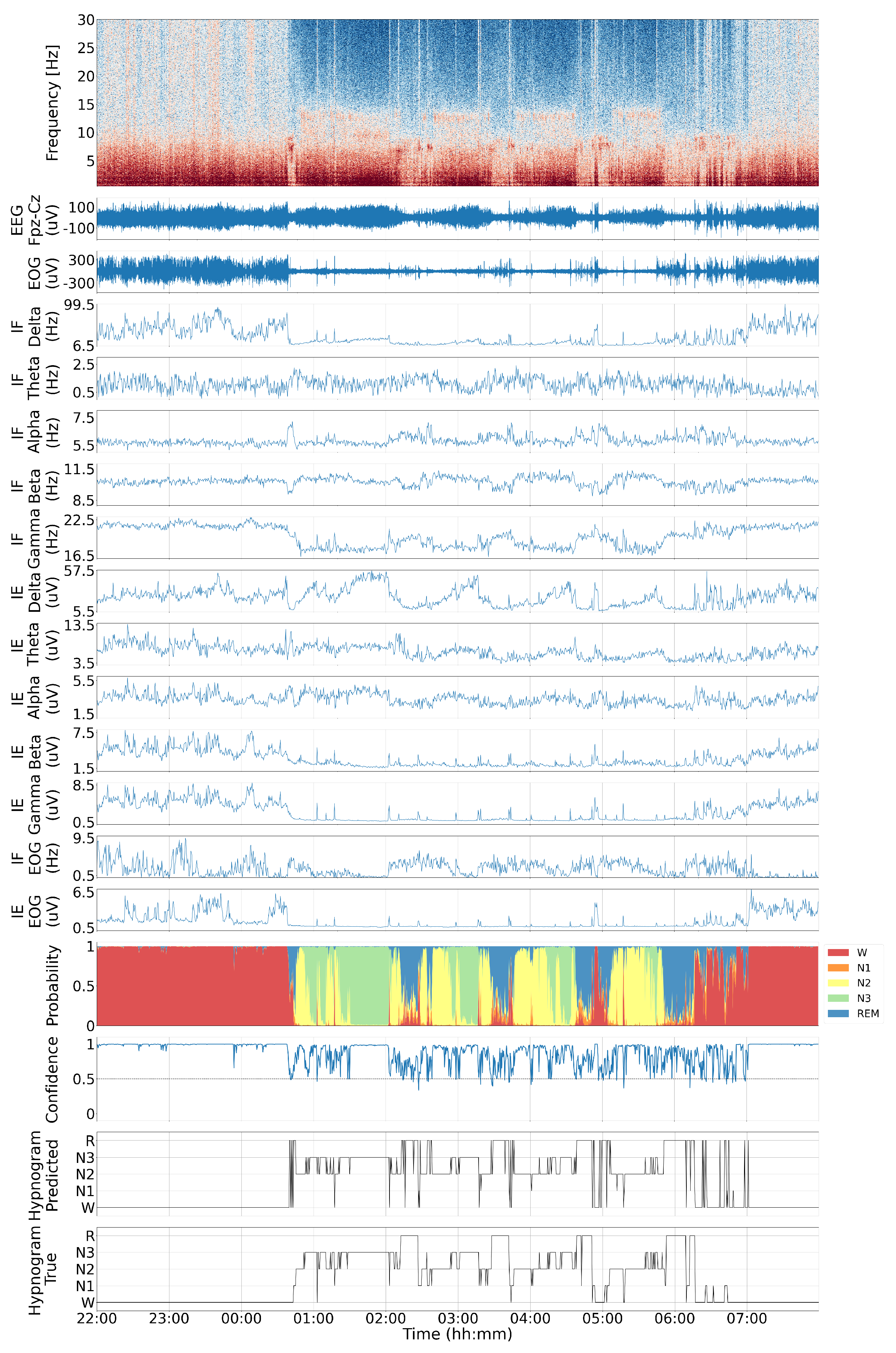 Model-Based Electroencephalogram Instantaneous Frequency Tracking ...