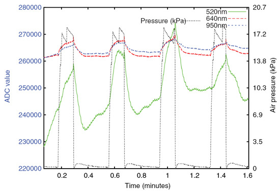 Research Progress on the Measurement Methods and Clinical Significance ...