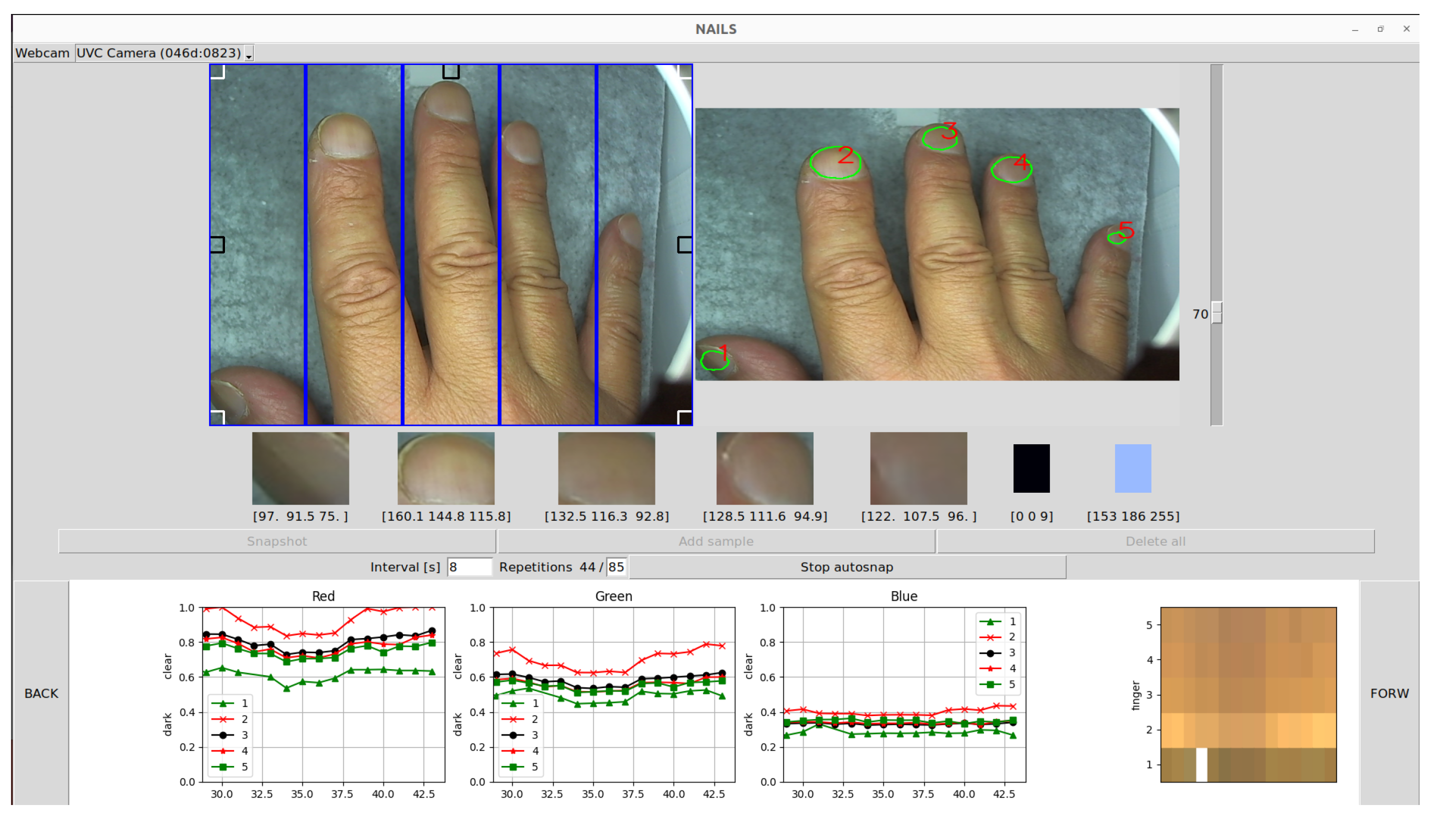 NAILS: Normalized Artificial Intelligence Labeling Sensor for Self-Care Health